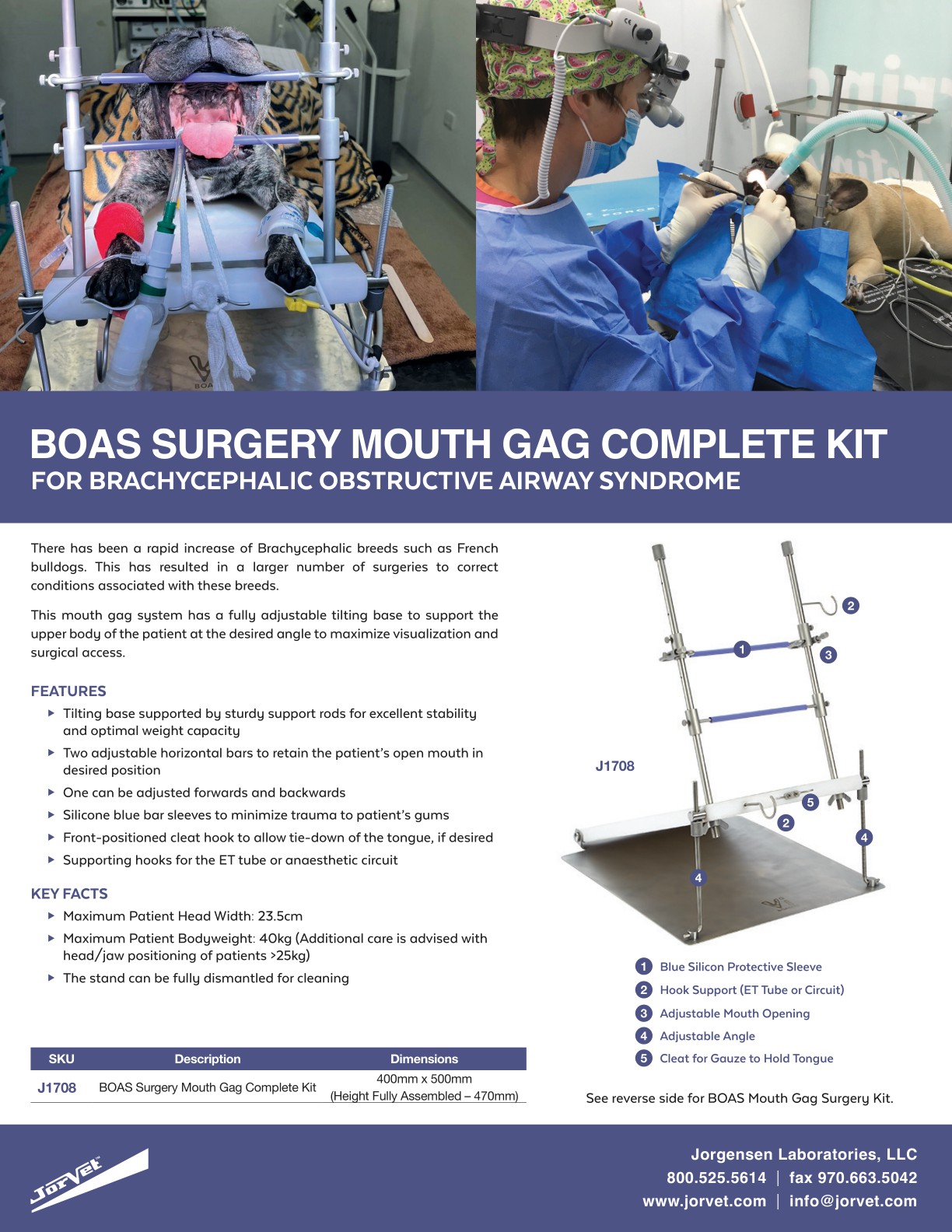 BOAS Surgery Mouth Gag Complete Kit Literature – LITJ1708 Series